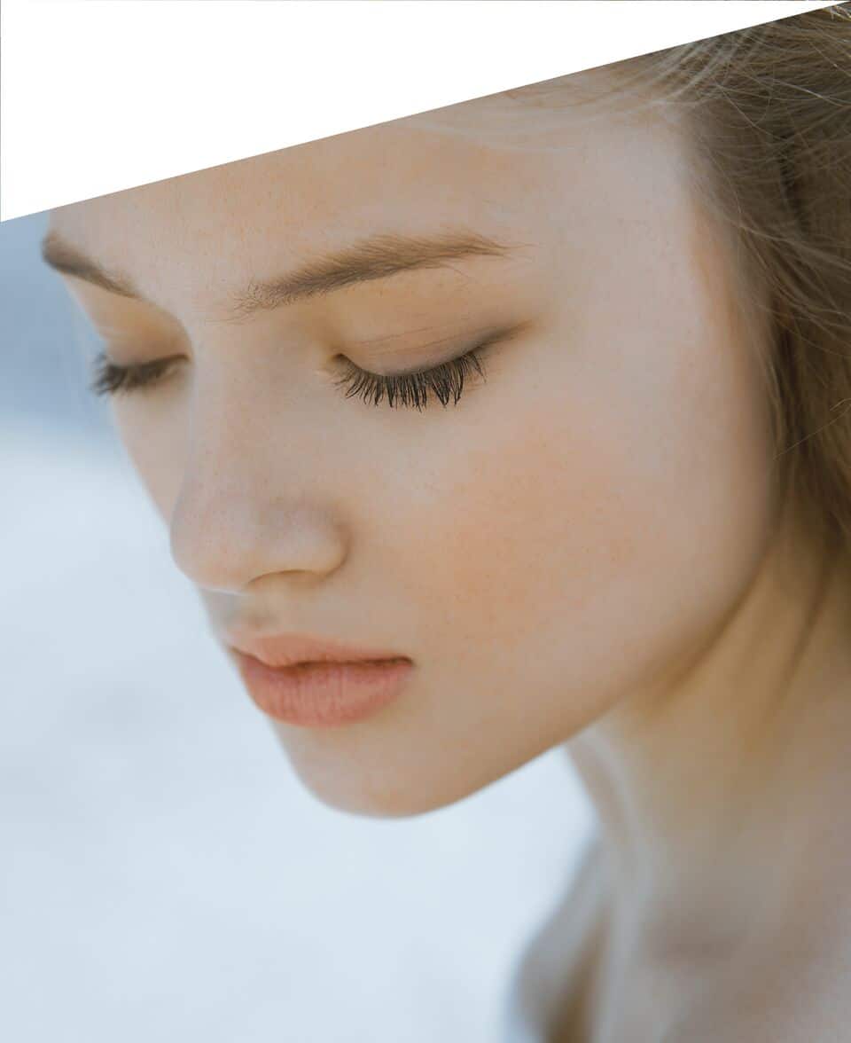 Acne Scar Removal New York City | Gotham Plastic Surgery